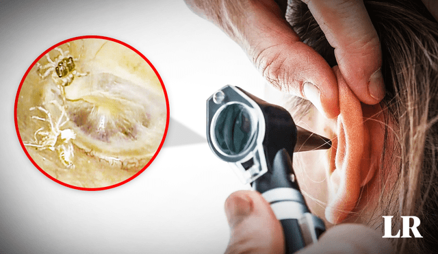 Mujer acude al médico por escuchar ruidos extraños y descubren una ...