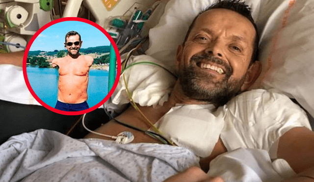 Hombre que perdió los brazos tras descarga eléctrica recibe un ...