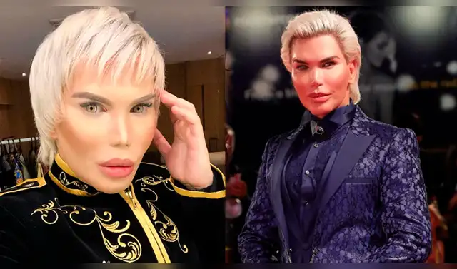 Ken humano y Barbie: Rodrigo Alves luce irreconocible tras 70 cirugías ...