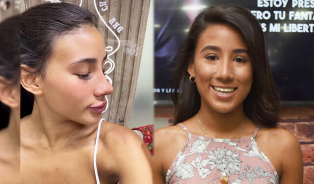 Samahara Lobatón se somete a operaciones en el rostro y muestra su ...