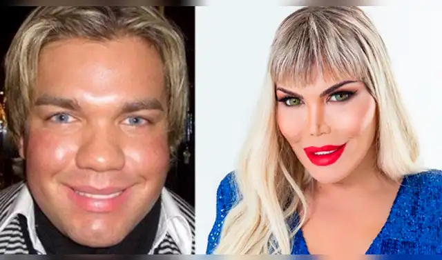 Facebook viral: ‘Ken humano’, muestra su rostro antes de las cirugías y ...