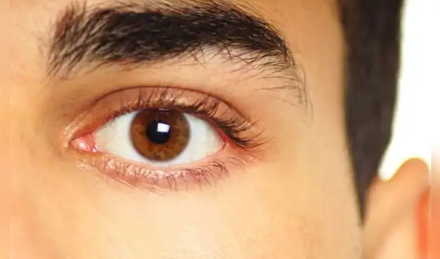 ¿Por qué late mi ojo y cuán peligroso es para mi salud? | estrés | qué ...